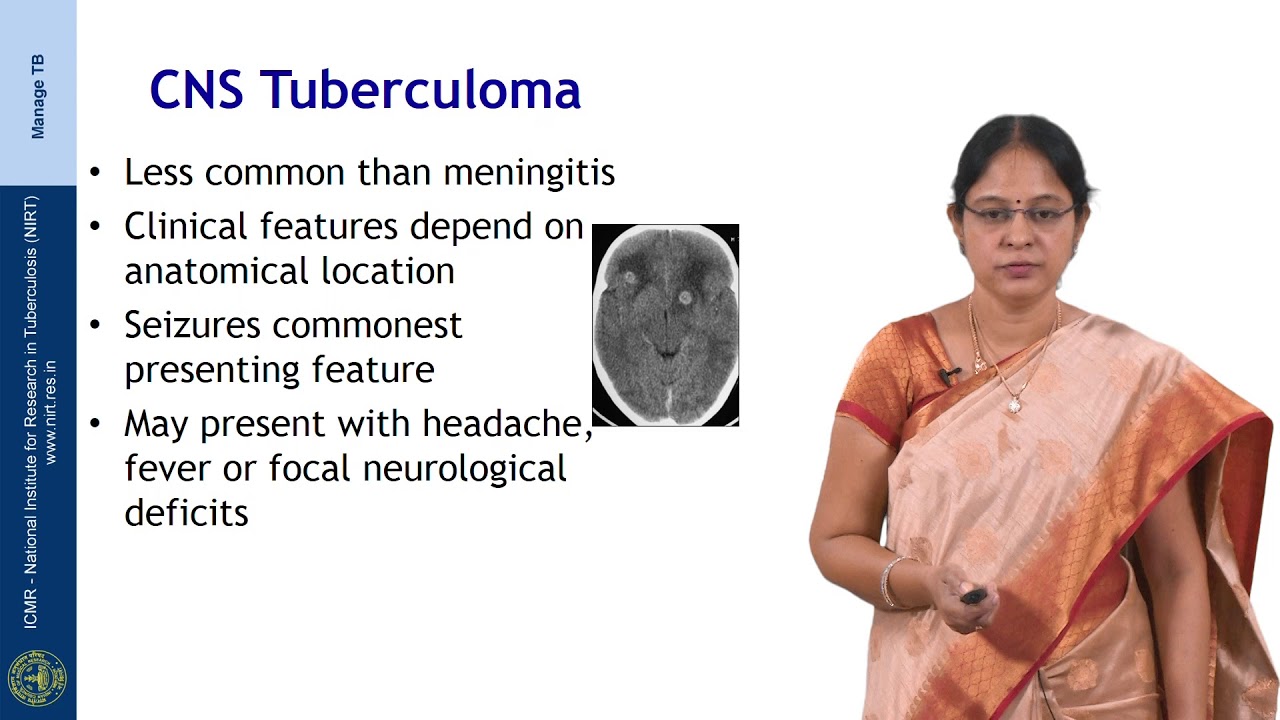 6 Clinical manifestations of TB Session 01 - YouTube