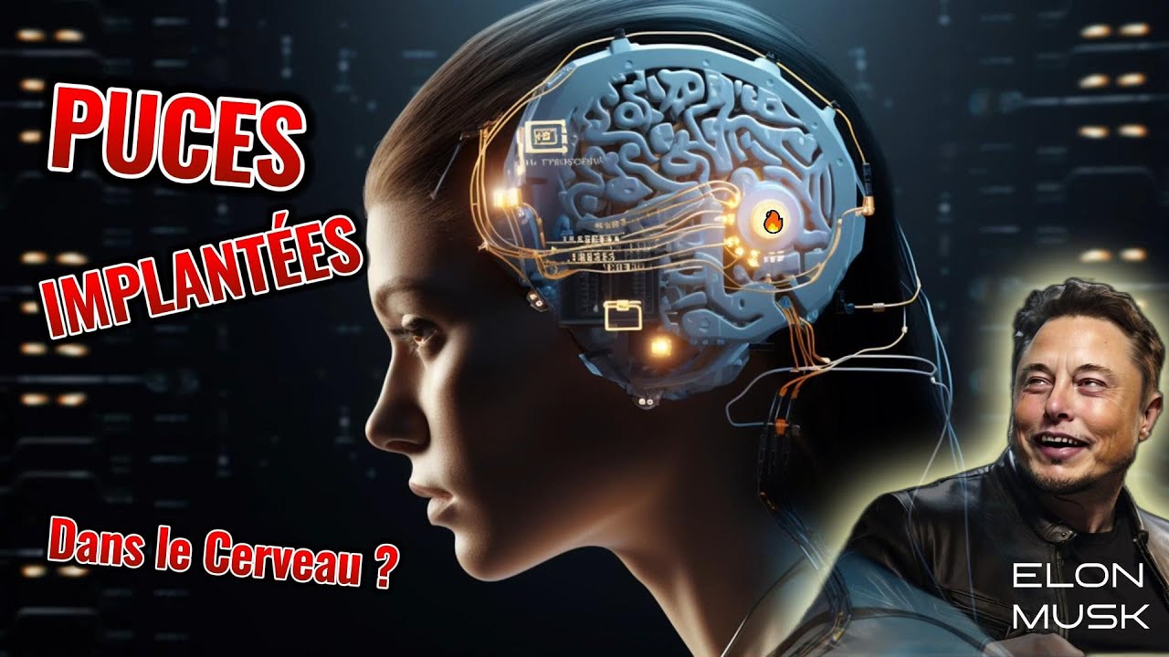 DES PUCES IMPLANTÉES DANS LE CERVEAU SELON ELON MUSK ? JÉSUS-CHRIST ...