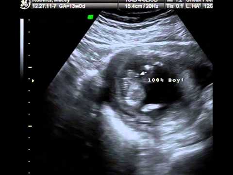 Felix Gabriel Sanders - 13 Week 3D/4D Ultrasound - 12/27/11 - YouTube