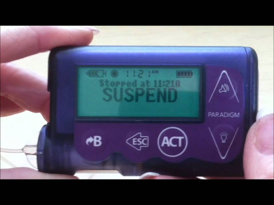 Metronic Paradigm Pump - YouTube