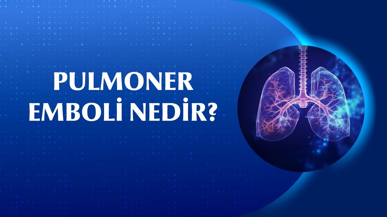 Pulmoner Emboli Neden Olur, Nasıl Tedavi Edilir? - YouTube