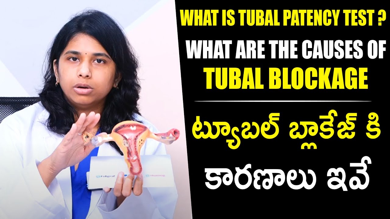 What Is Tubal Patency Test? Whar Are The Causes of Tubal Blockage | Dr ...
