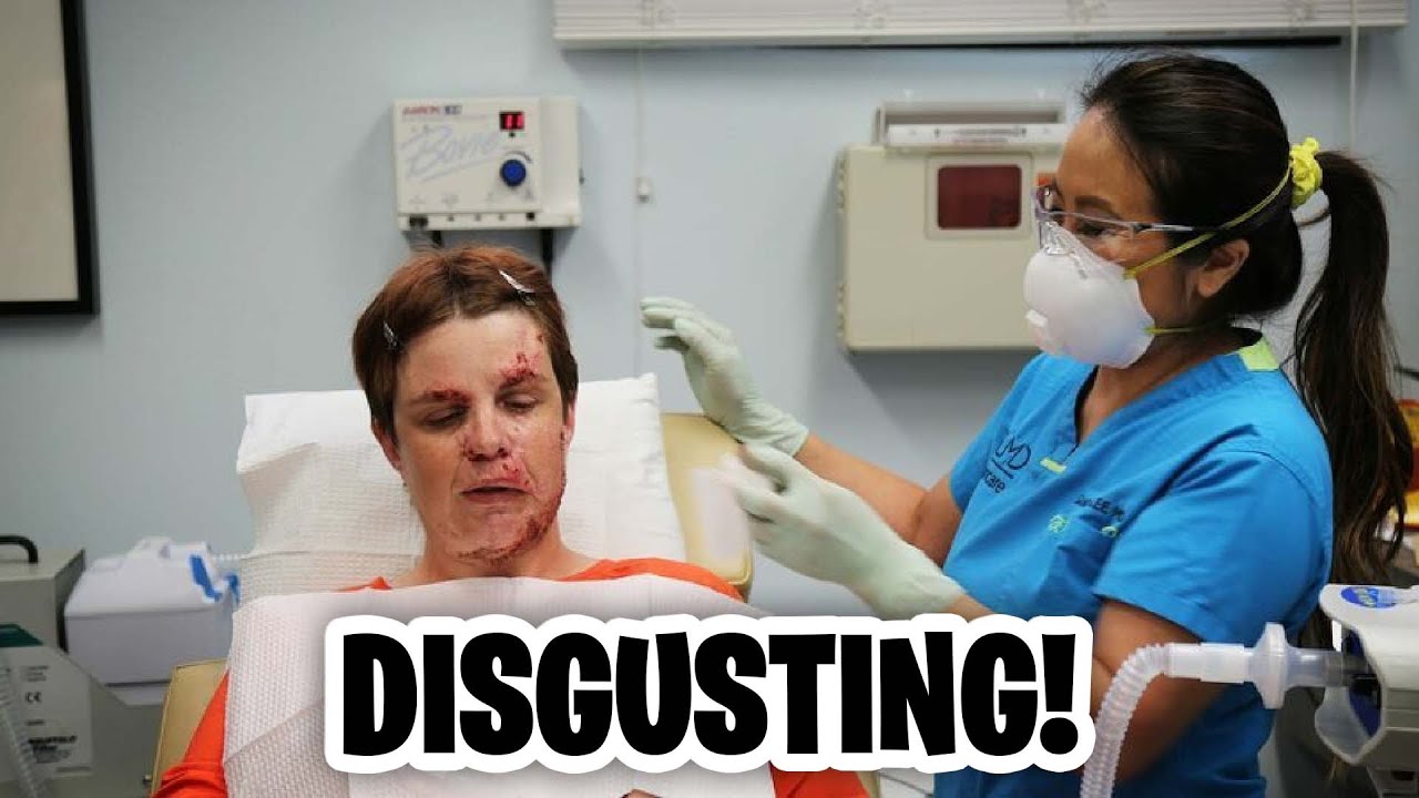 4 Of The Most DISGUSTING Dr. Pimple Popper Moments EVER! Part 19 - YouTube