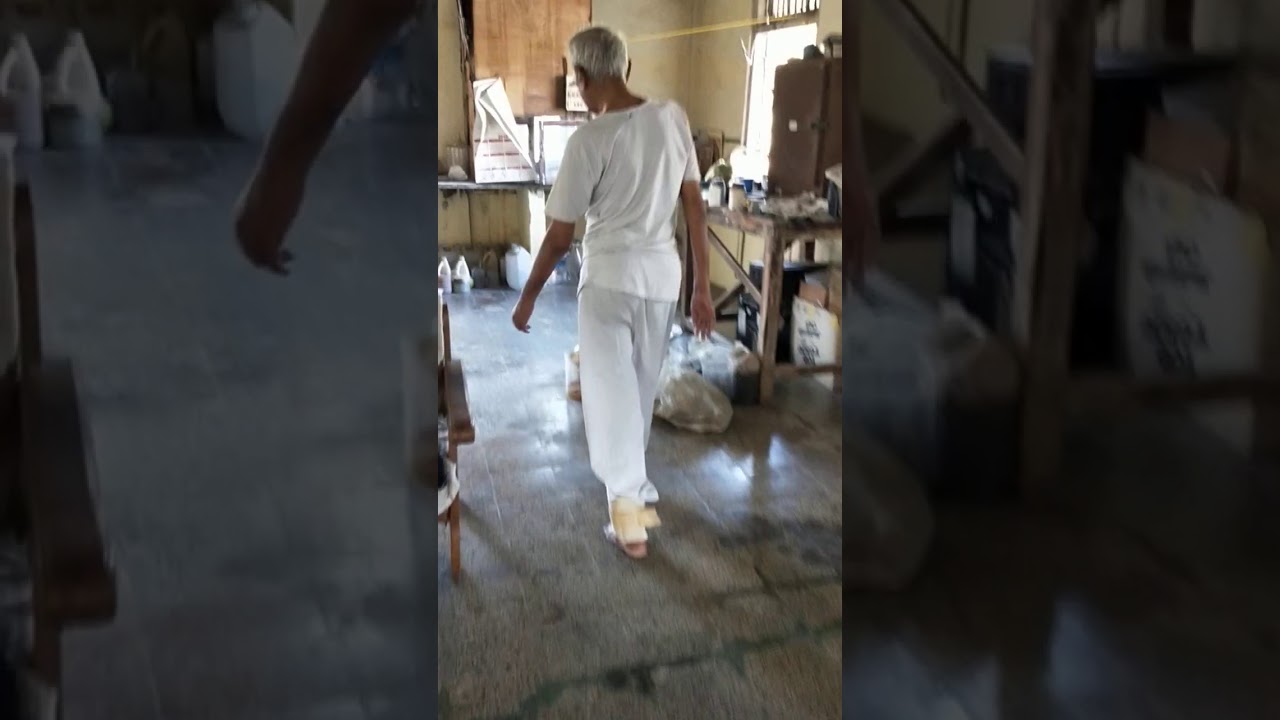 left side body paralysis-hemiparesis - YouTube