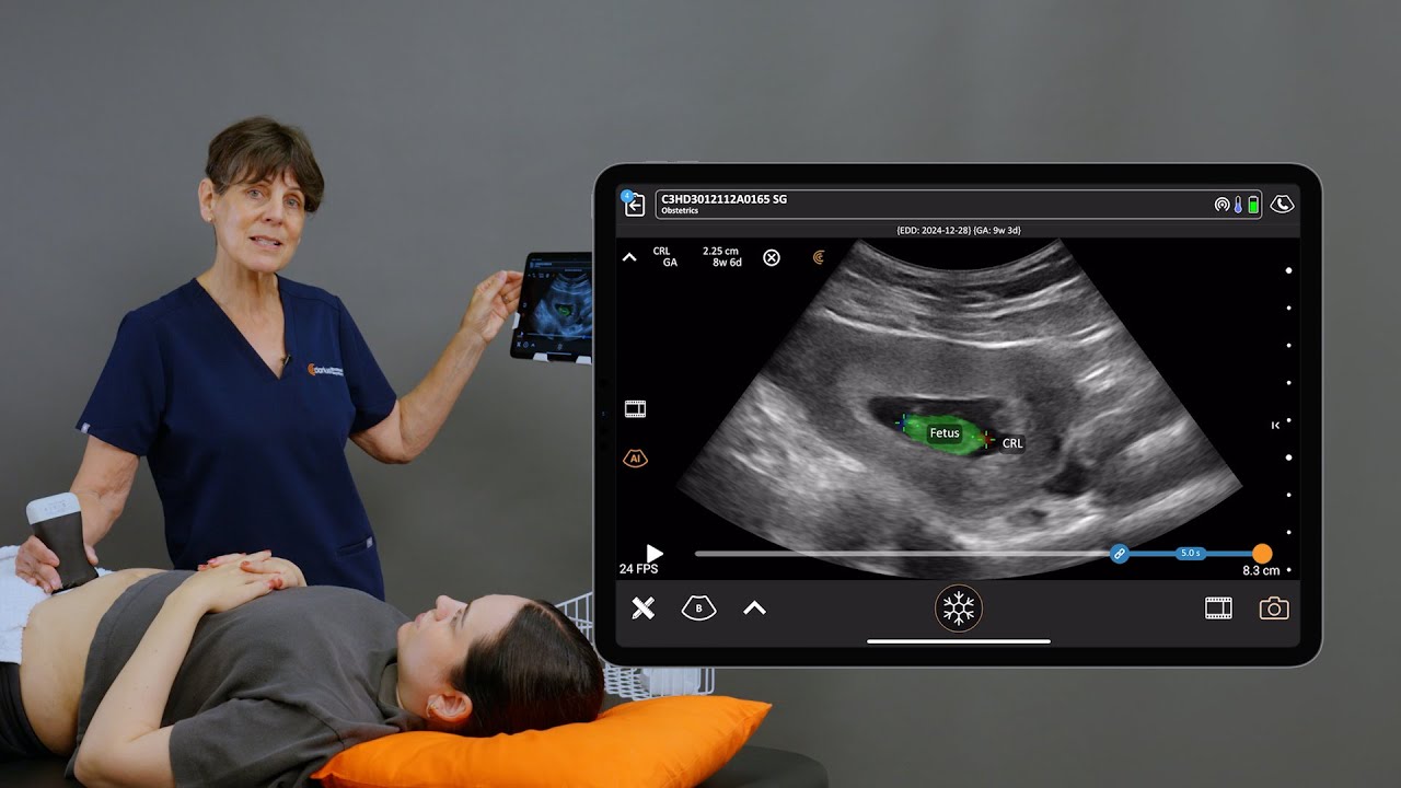 OB AI for Crown Rump Length (CRL) - YouTube