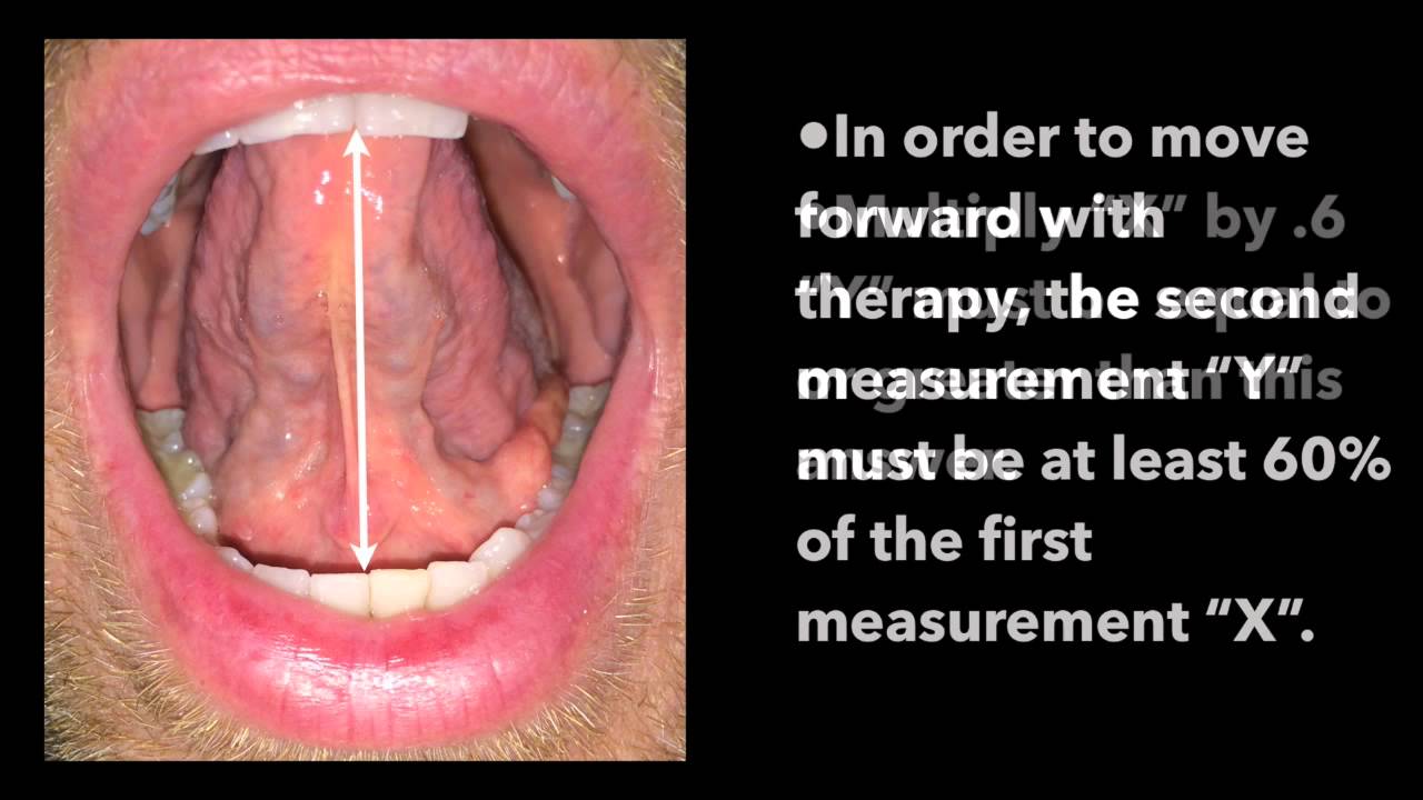 Myofunctional Therapy Self-Check Help - YouTube