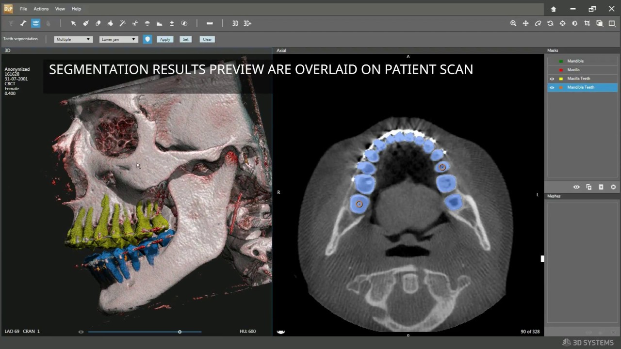 D2P CMF Orthognathic tools - YouTube