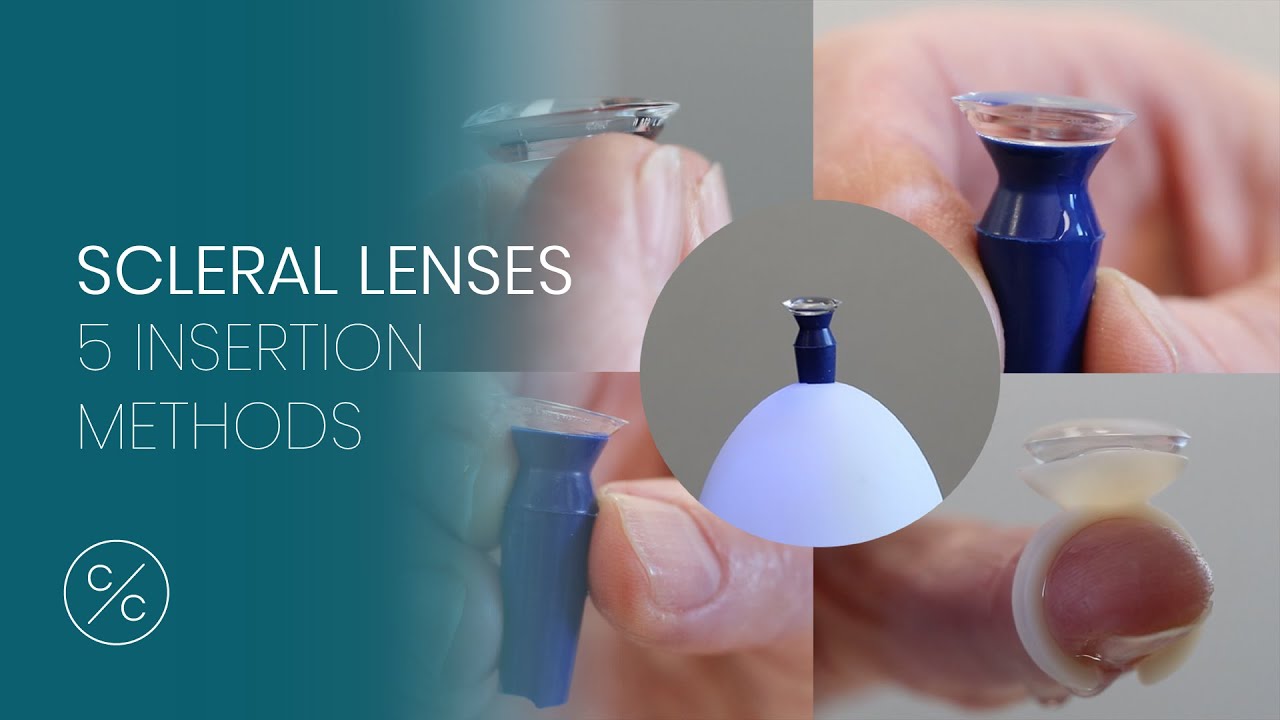 5 Insertion Methods For Scleral Lenses Contacts With Conway YouTube