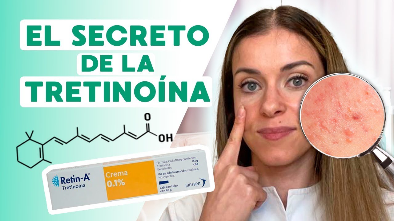 Tretinoína sin riesgos: Consejos prácticos - YouTube