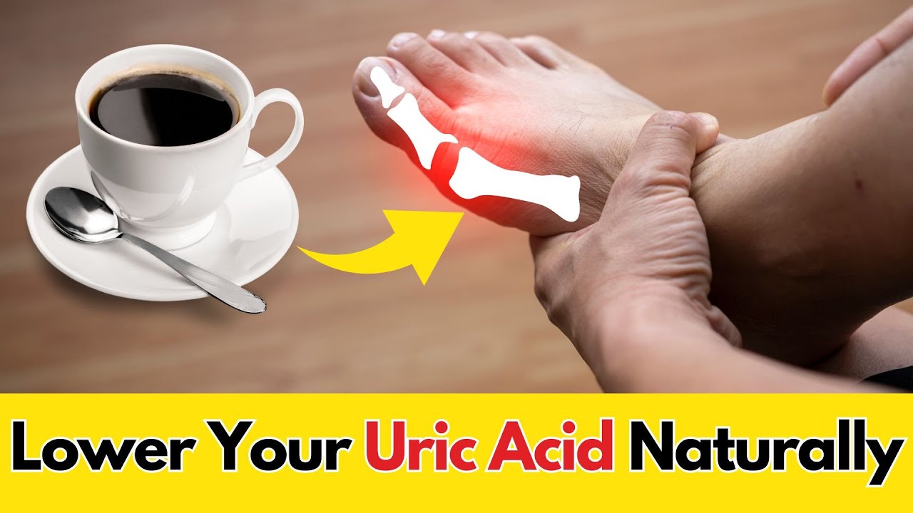 Lower Your Uric Acid Levels Naturally With These 10 Effective Methods ...
