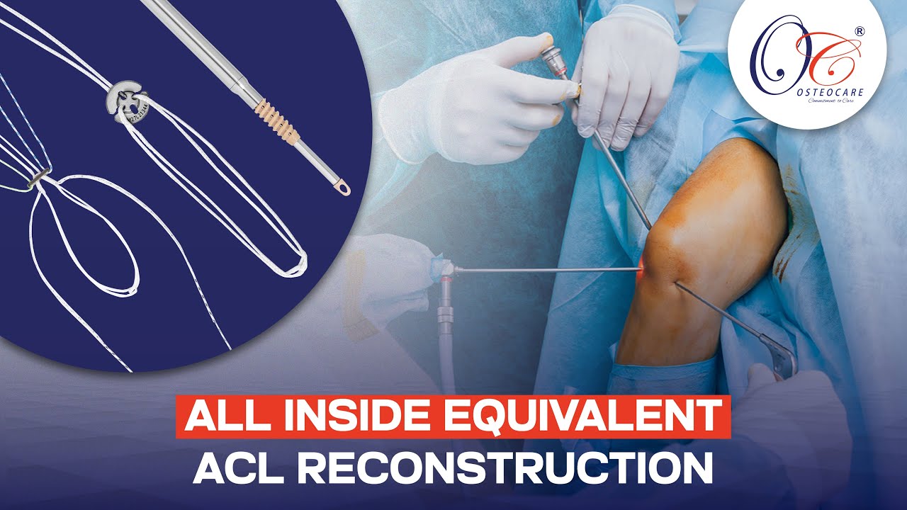 All Inside Equivalent ACL Reconstruction | Surgical Video | Relive - YouTube