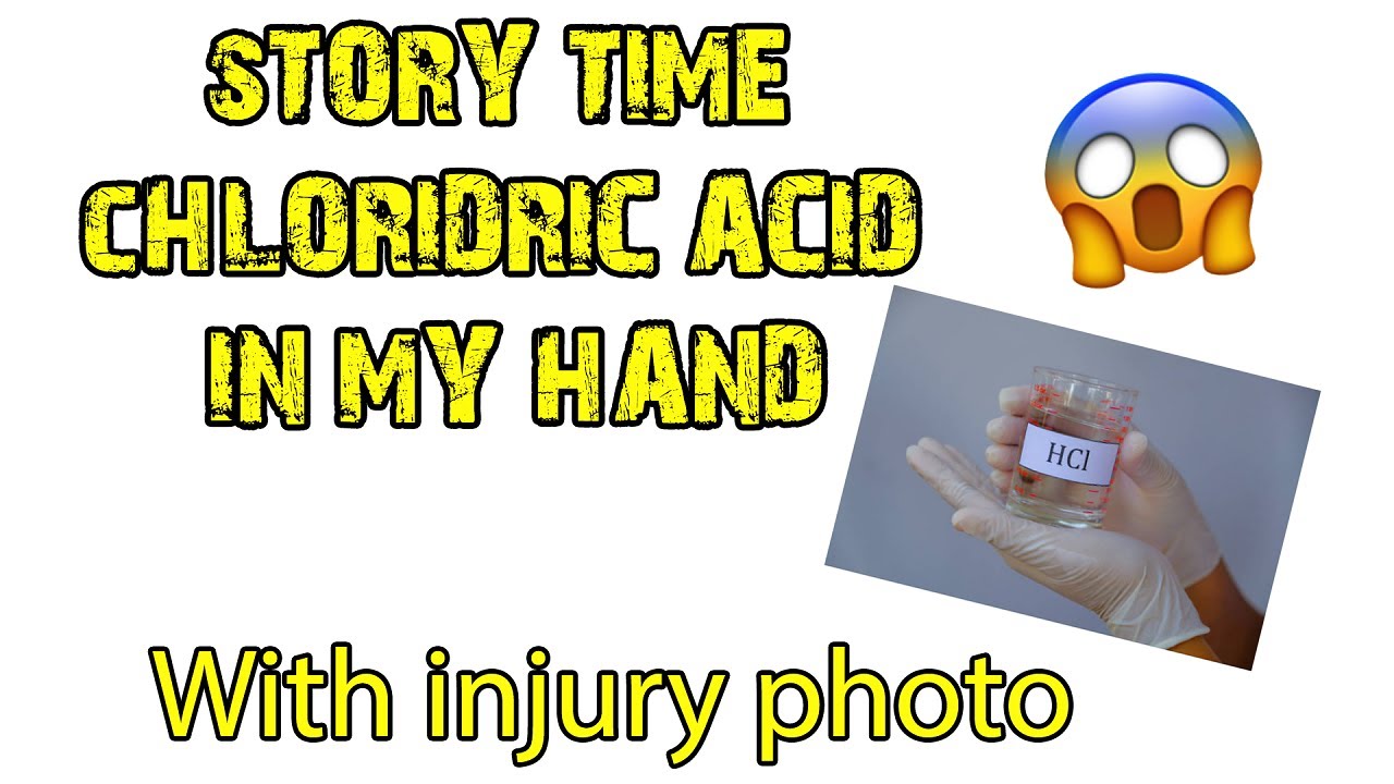 Story time - Incident with HCl acid in my hand (Real photo) - YouTube
