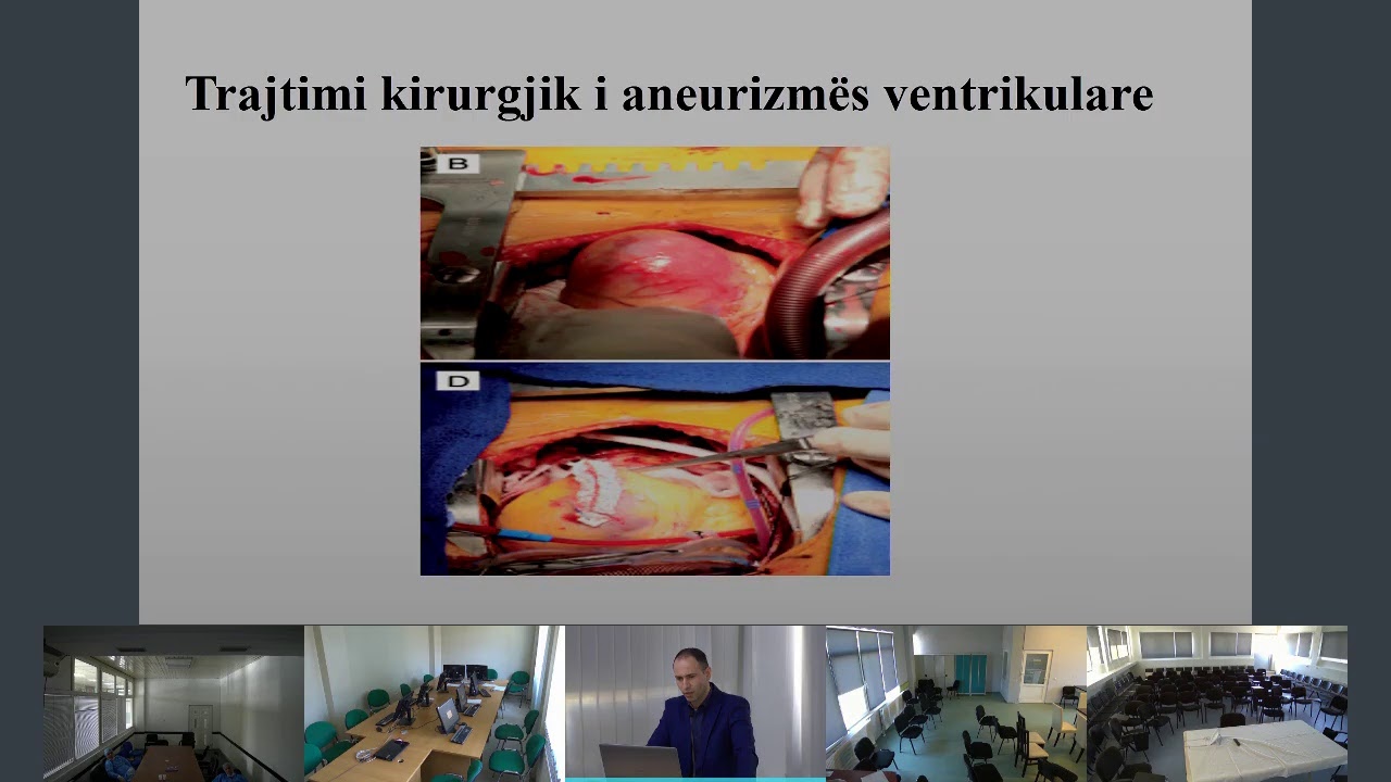 Dr Rifat Brahimaj; Trajtimi kirurgjik i komplikimeve te infarktit akut ...