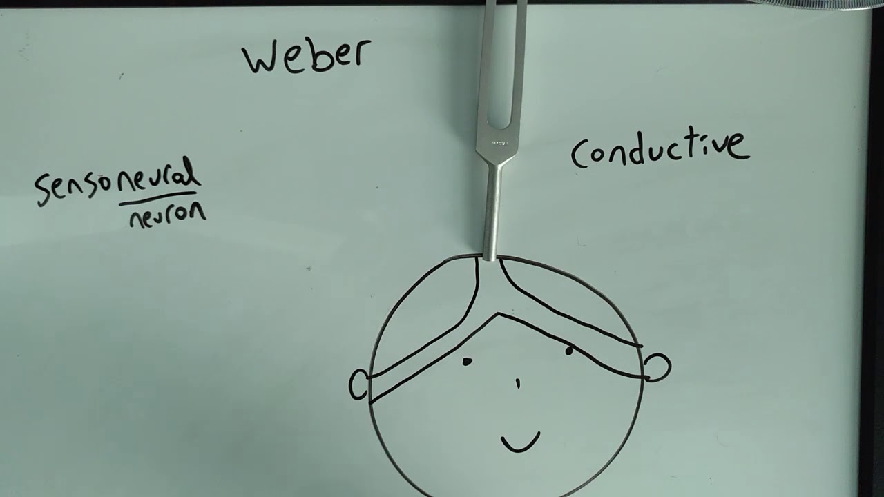 Weber Test made easy Sensoneural/Conductive hearing loss USMLE - YouTube