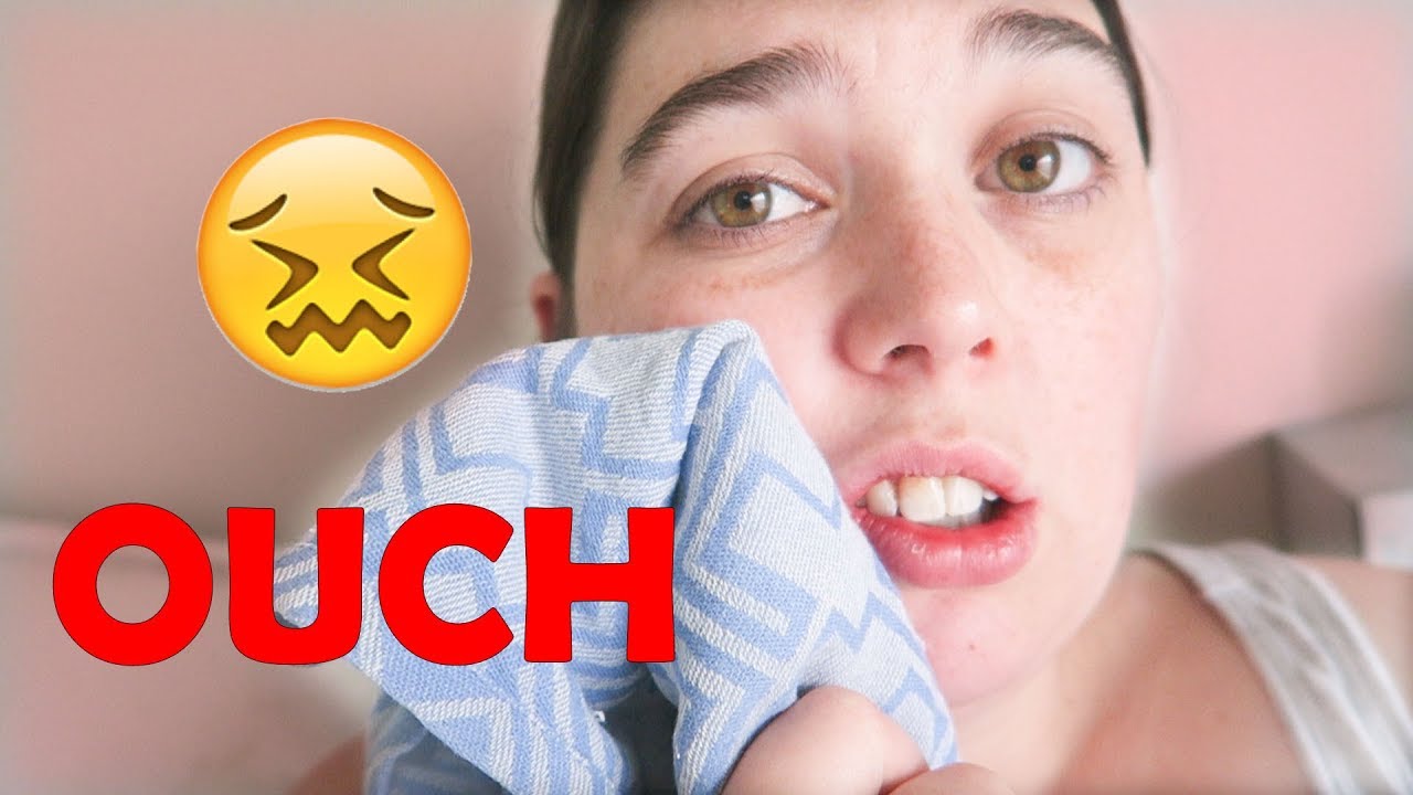 PAINFUL TOOTH EXTRACTION EXPERIENCE (surgical) - YouTube