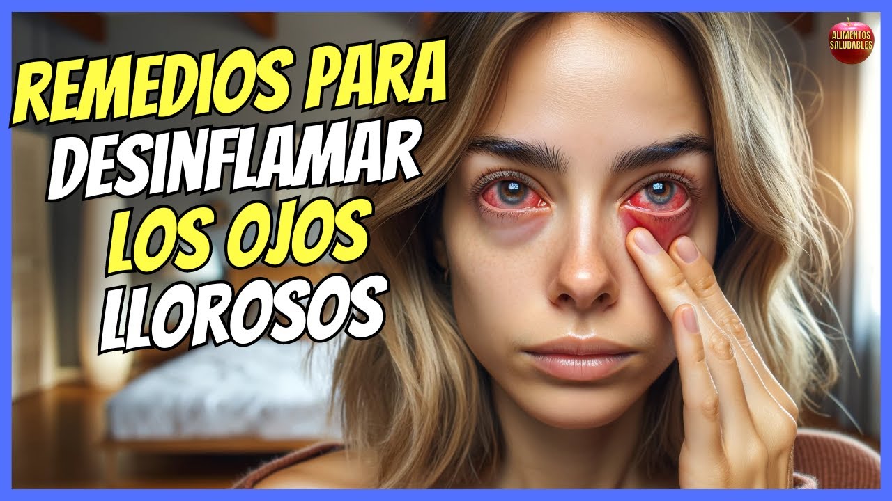 🔴 REMEDIOS CASEROS PARA DESINFLAMAR LOS OJOS LLOROSOS 🔴 - YouTube