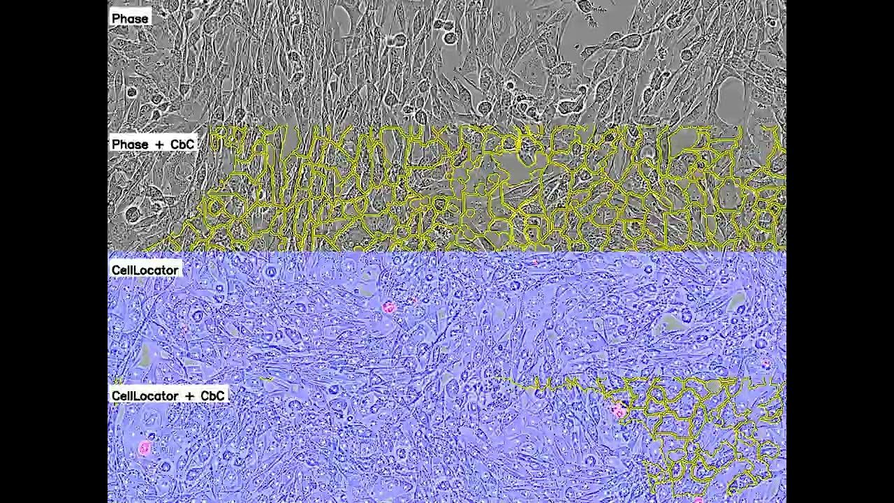 CellLocator vs. Incucyte® Cell-By-Cell: High Confluence - YouTube