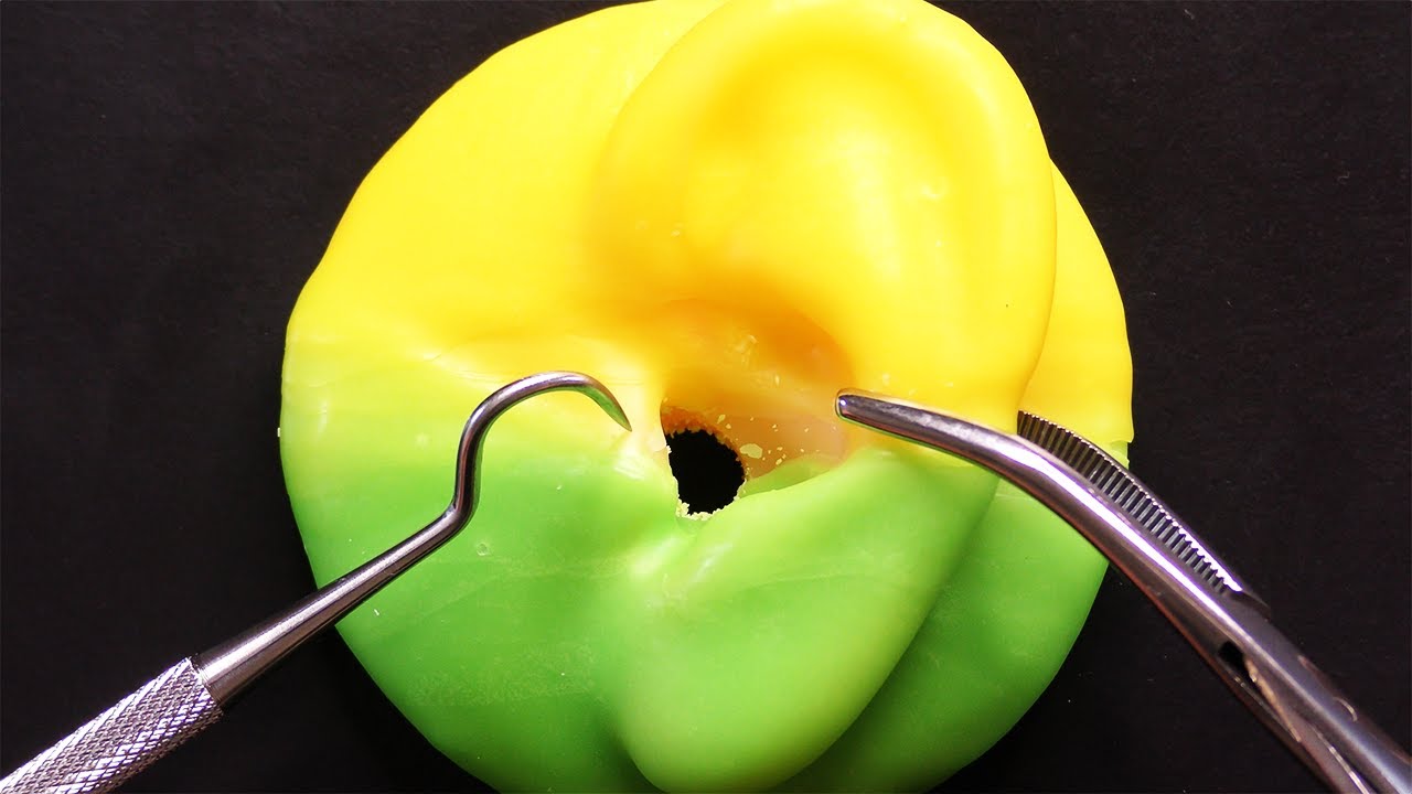 ASMR Super Crunchy Ear Cleaning - YouTube