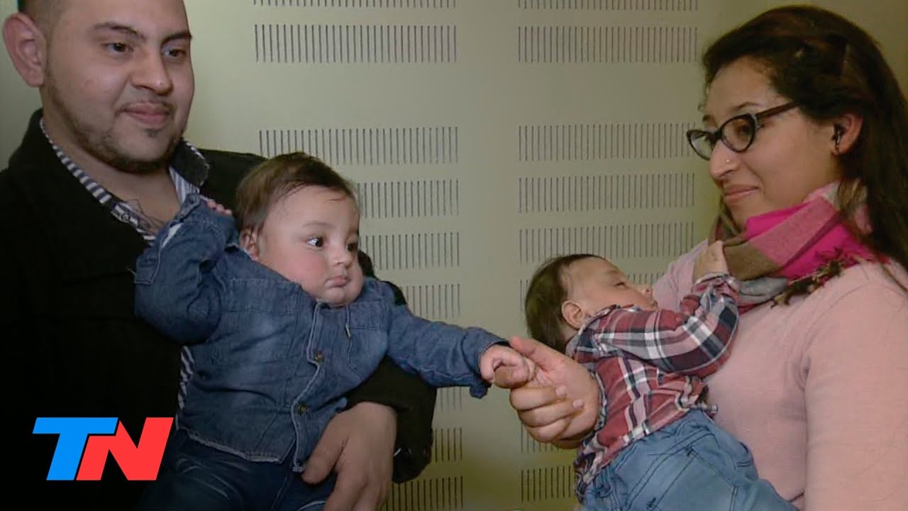 Santino y Gianluca, los siameses separados en una operación con una ...