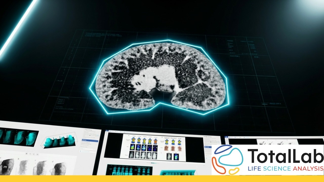 How to Quantitively Analyze Phosphor Images Using Phoretix Toolbox ...