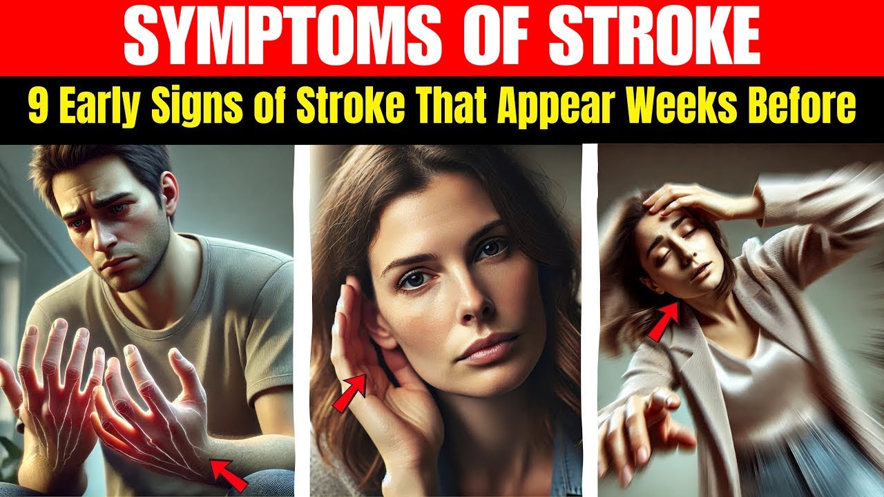 9 Early Warning Signs of Stroke Weeks Before It Happens (Don’t Ignore ...