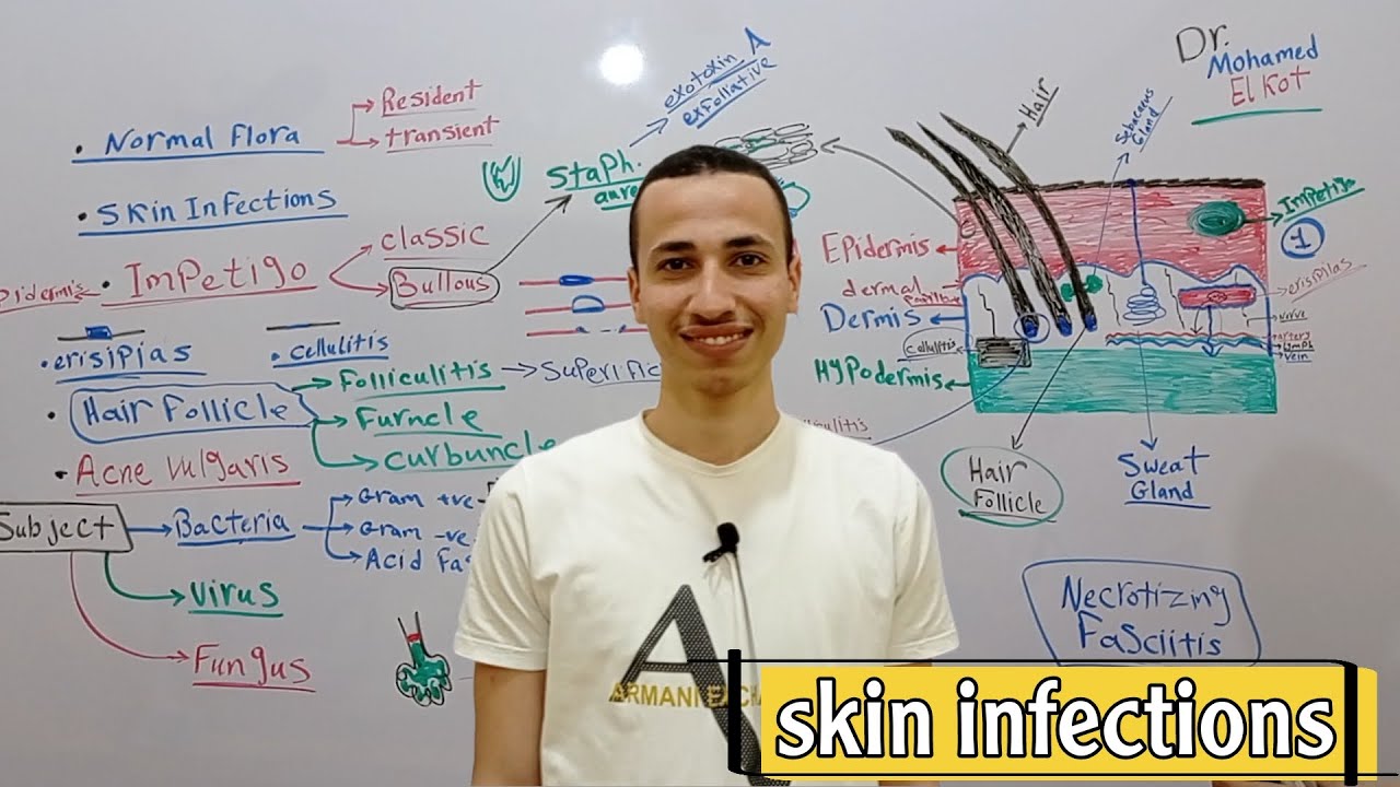 Skin Infections | Introduction to MSK Microbiology | Dr. Mohamed El Kot ...