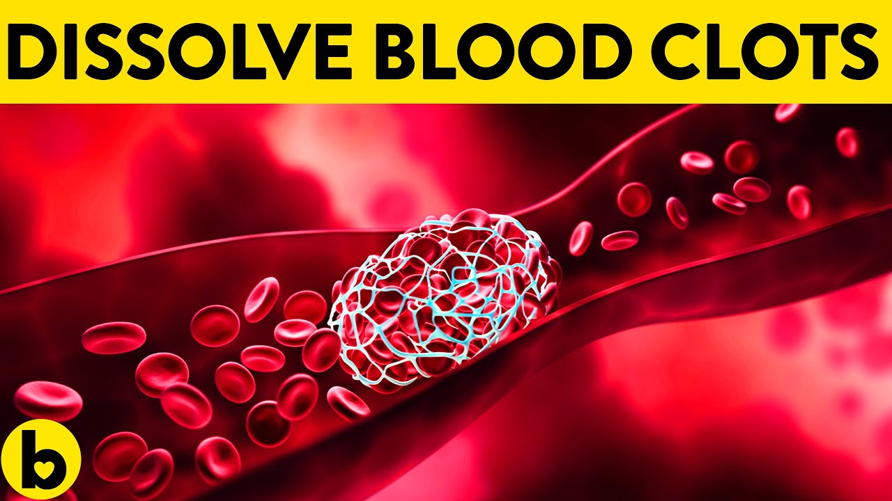 9 Fruits That Dissolve Blood Clots Naturally - YouTube