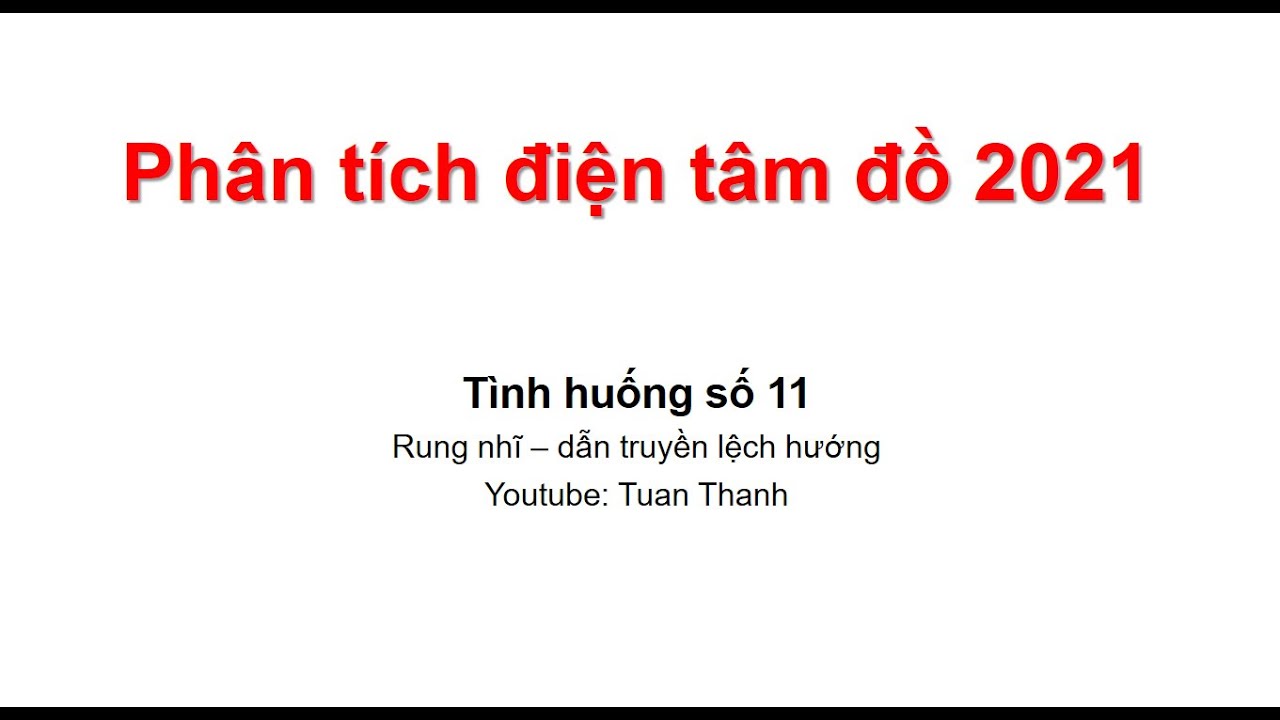 Electrocardiography 11: Atrial fibrillation + Ashman Phenomenon - YouTube