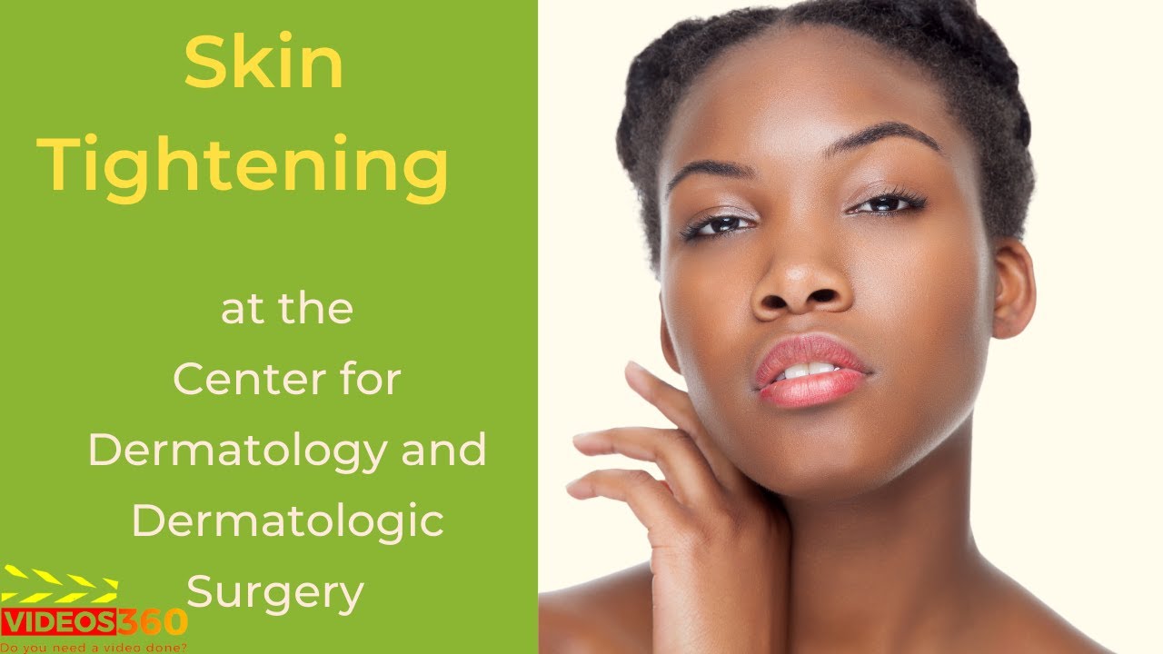 Skin Tightening at the Center for Dermatology and Dermatologic Surgery ...