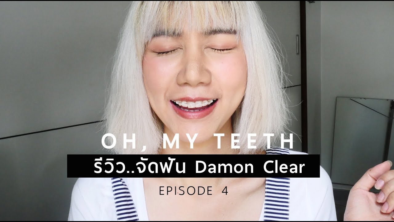 Oh! my teeth :: EP.4 รีวิว! จัดฟันแบบใส Damon Clear ใสจริงป่าวไหนดูซิ. Ploy Sapphires - YouTube