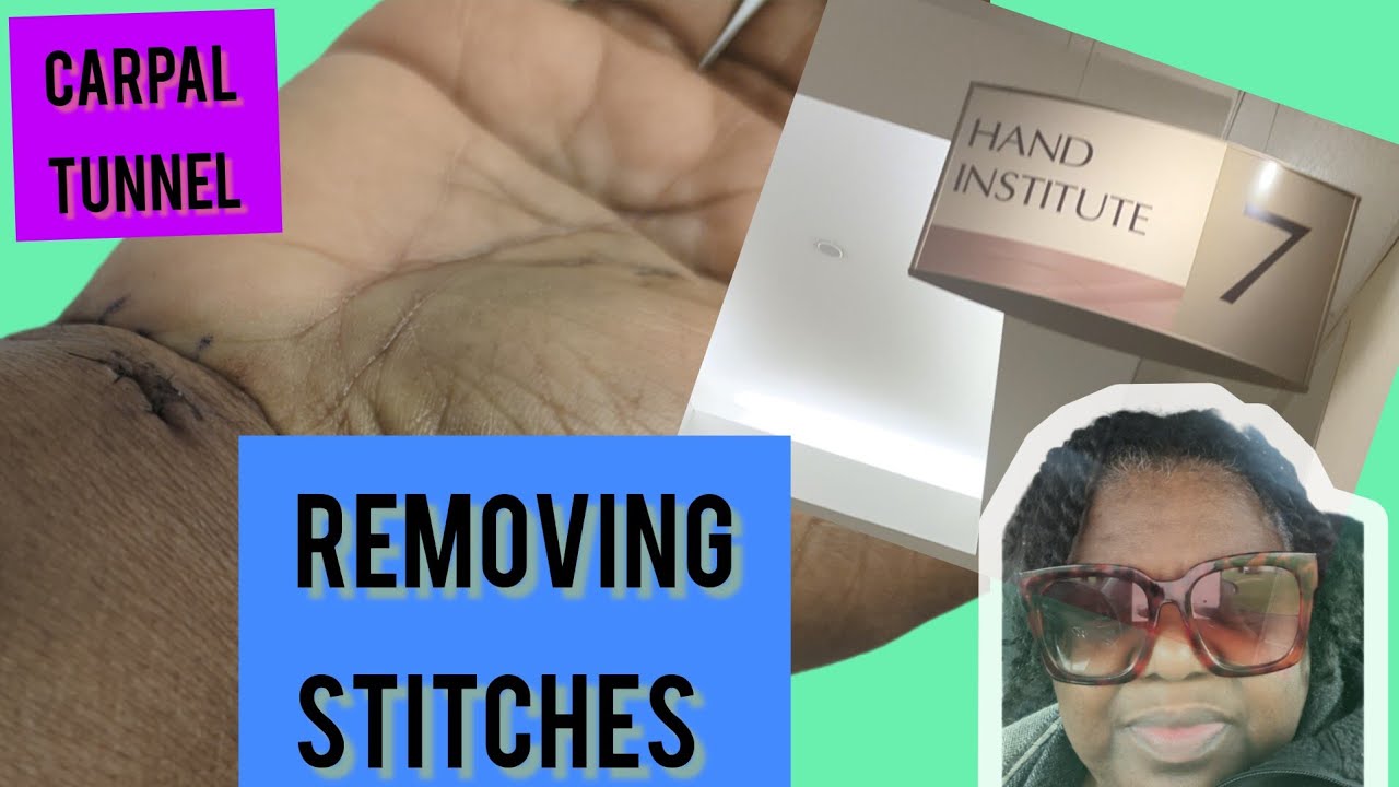 CARPAL TUNNEL REMOVAL OF STITCHES DAY 6 POST OP 👍 #triggerthumb # ...