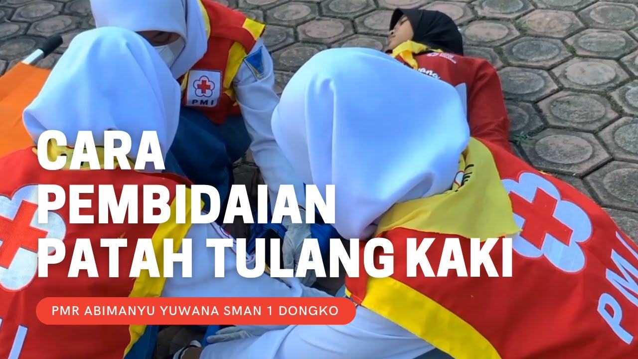 Cara Pembidaian Patah Tulang Kaki - YouTube