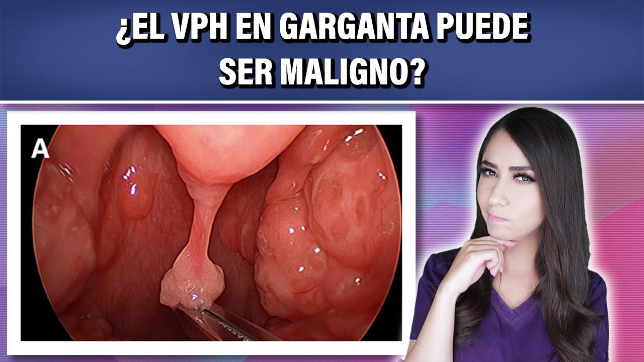 ¿El VPH en garganta puede ser maligno?👩🏻‍⚕️l Dra. Pau Zúñiga CLIPS ...