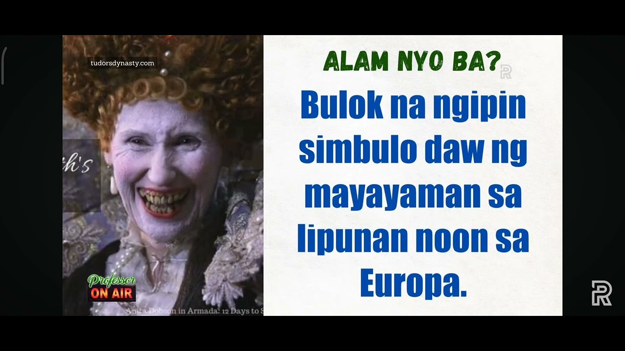 Bulok na ngipin simbulo daw ng mayayaman sa Europa noon! - YouTube