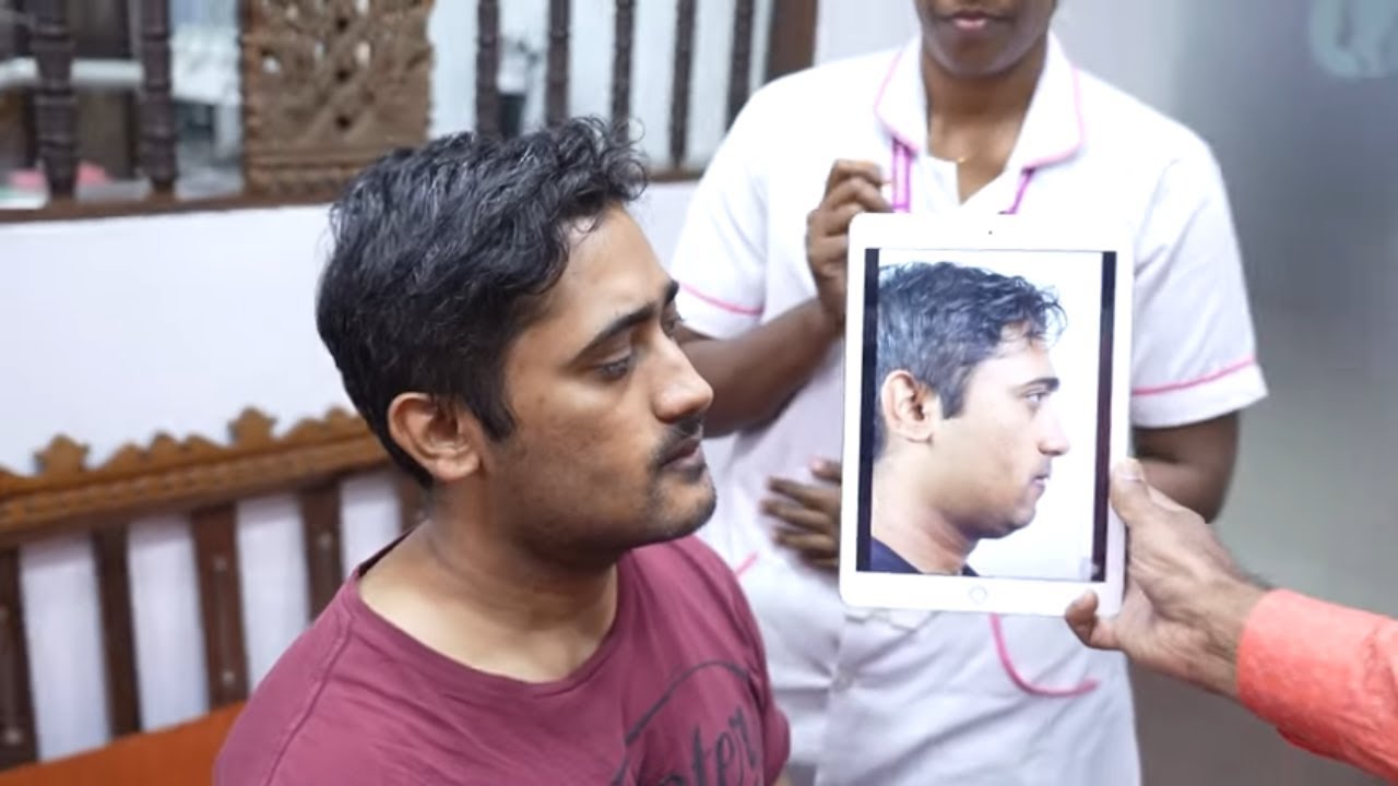 Jaw Surgery - Amazing Transformation Before & After - YouTube