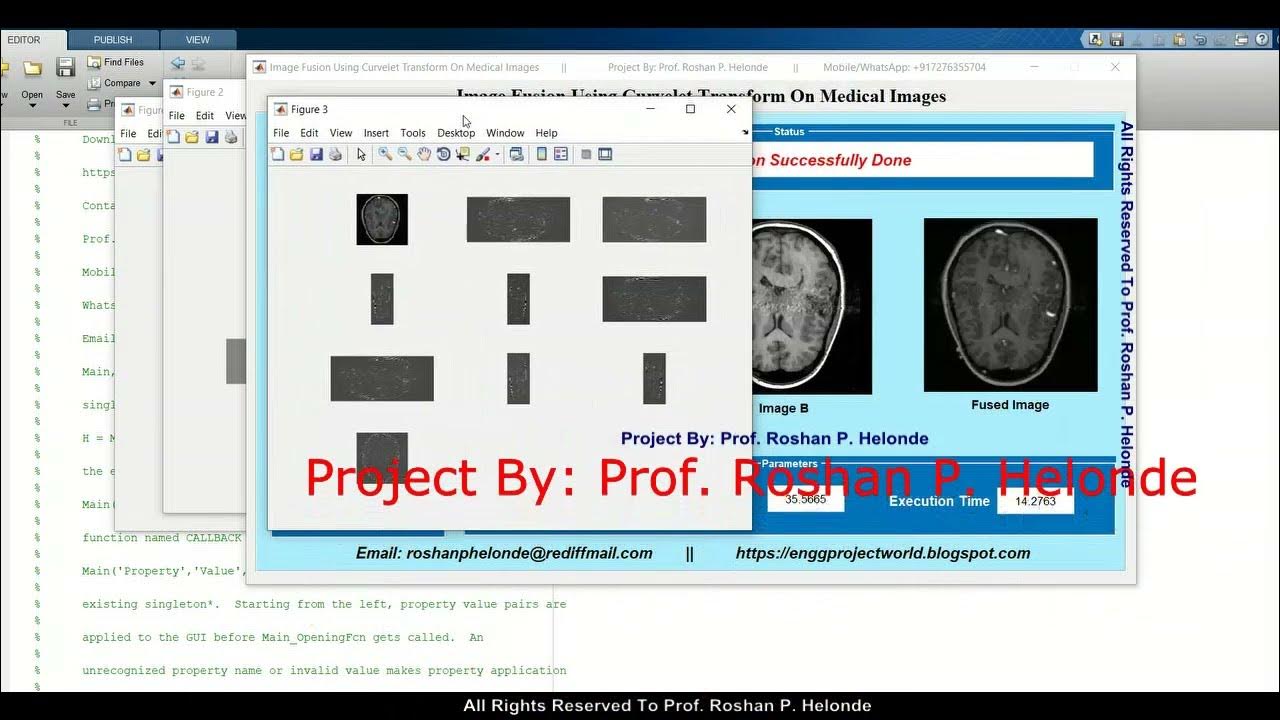 Image Fusion Using Curvelet Transform Technique | Medical Image Fusion Using Matlab Project Code ...