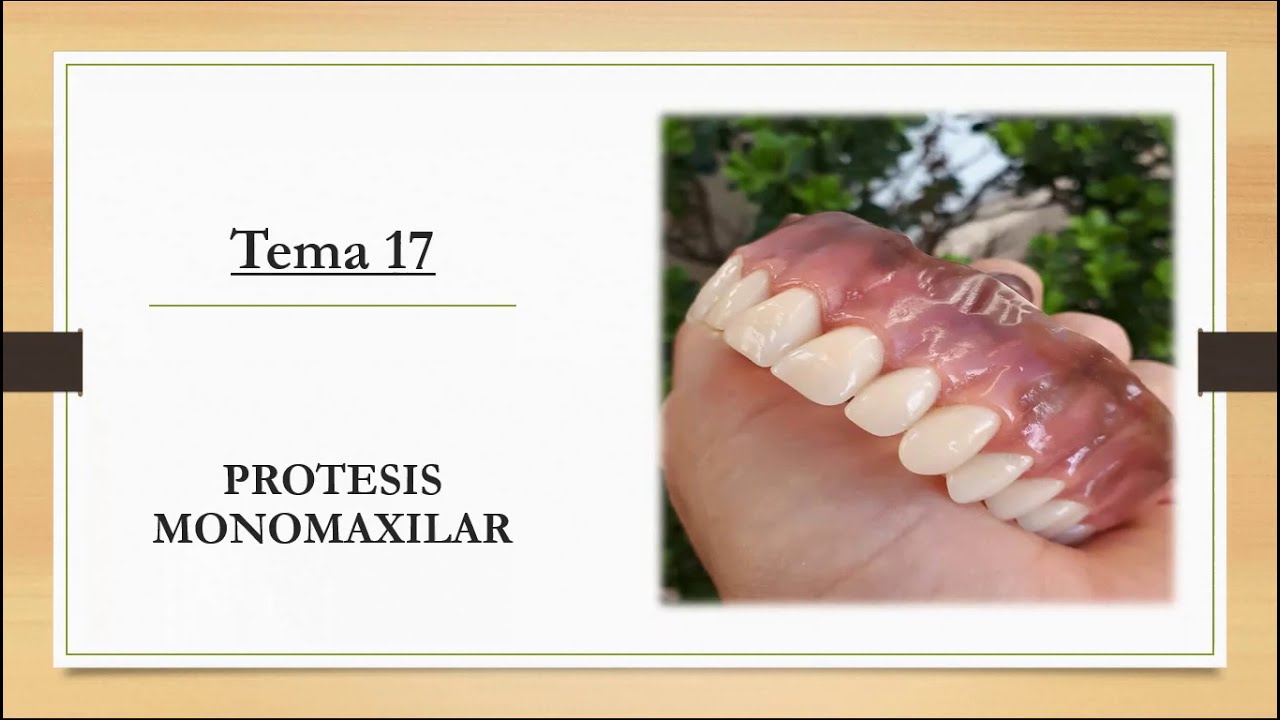 cuales son los procedimientos para una prótesis mono maxilar - YouTube