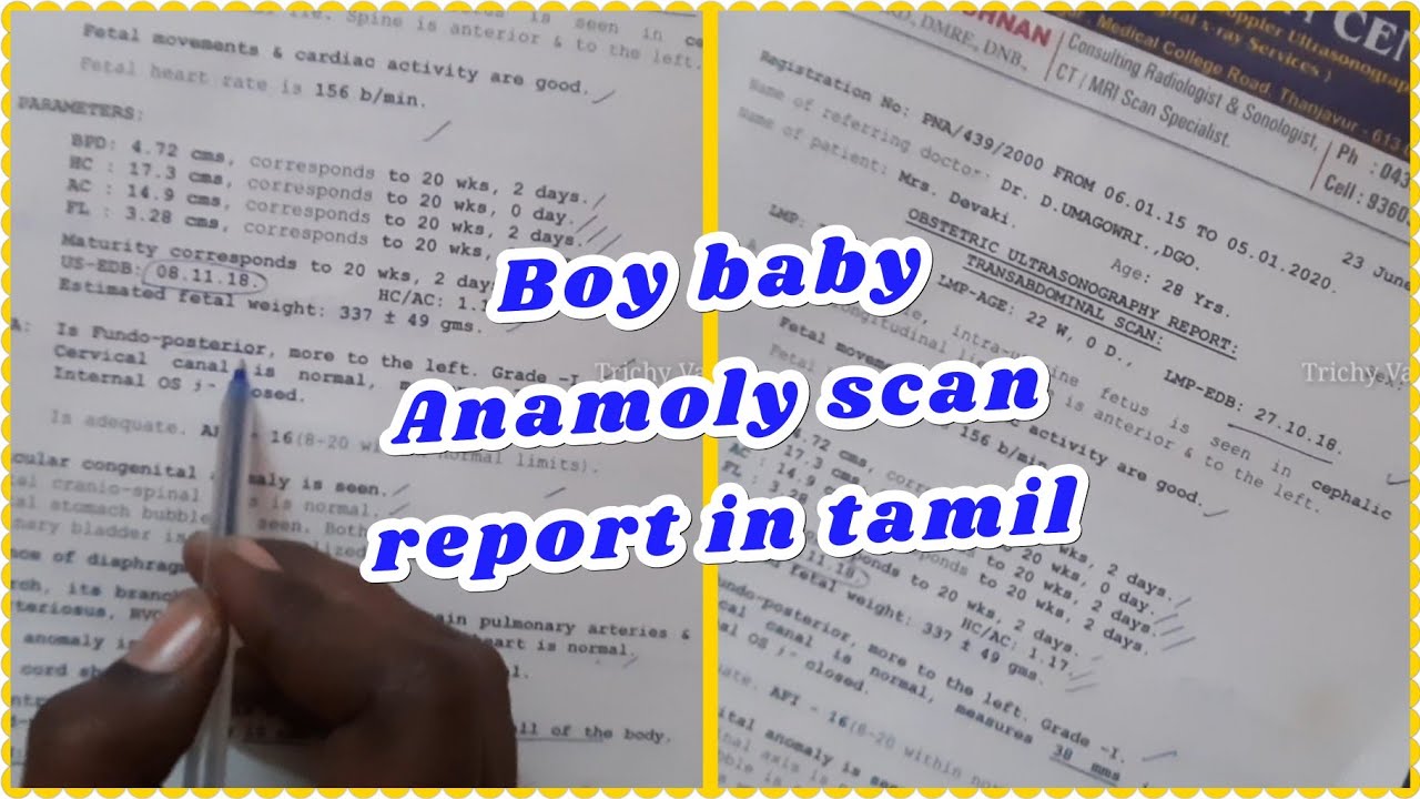 Boy Baby Anomaly Scan Report In Tamil Anamoly Scan Detailed Report In boy-baby-anomaly-scan-report-in-tamil-anamoly-scan-detailed-report-in