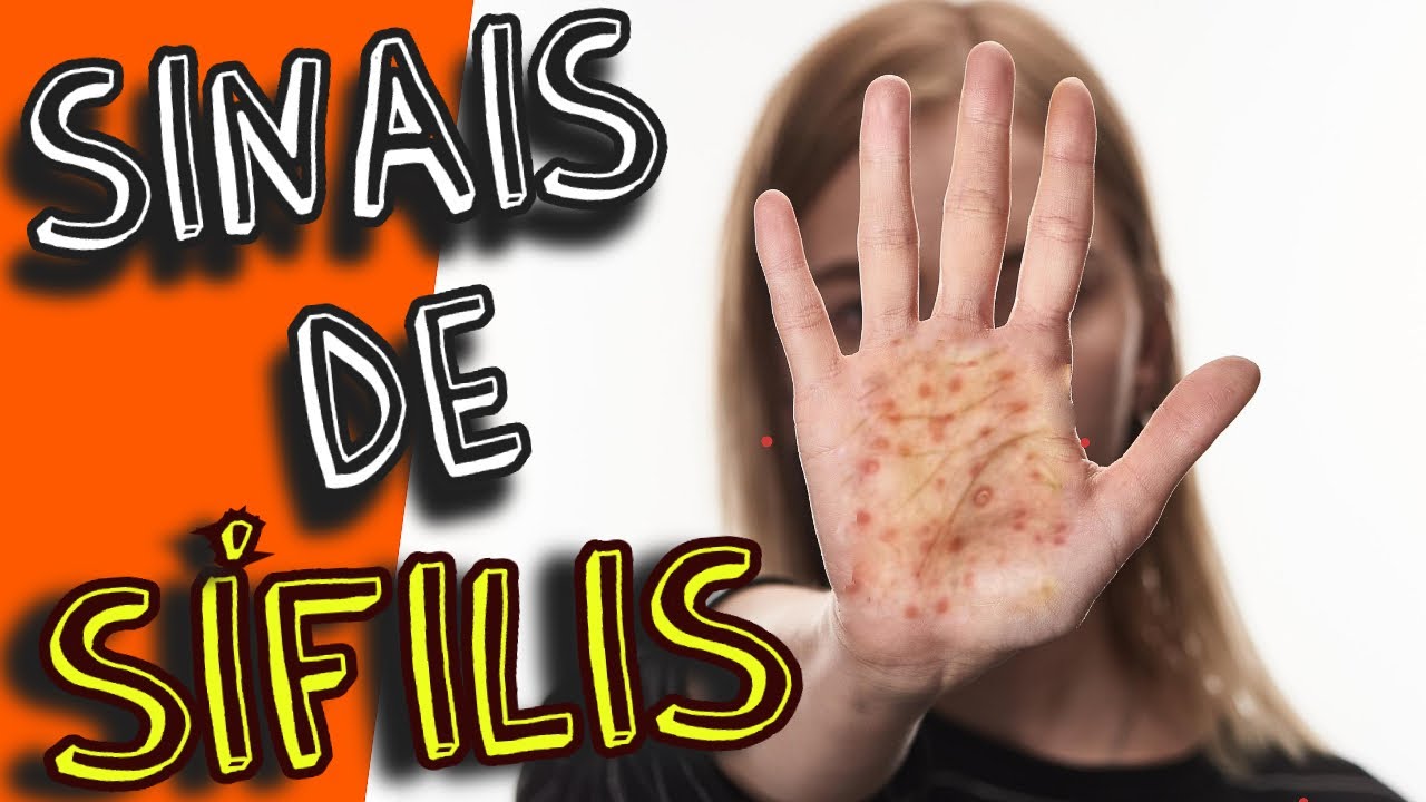 SÍFILIS: quais os sintomas dessa doença silenciosa? (2024) - YouTube