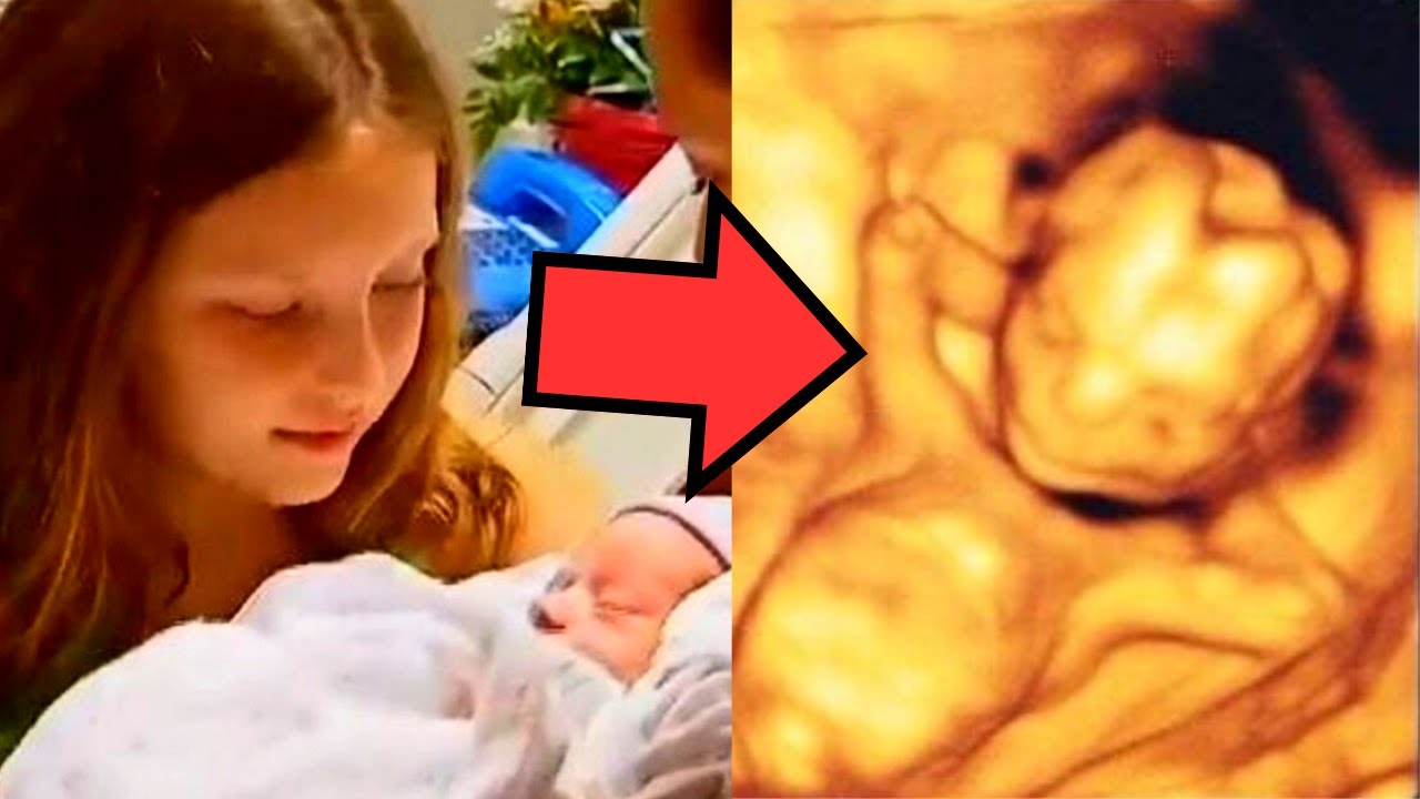 11 Year Old Delivers Baby Despite Risks, Doctors Found Another Moving ...