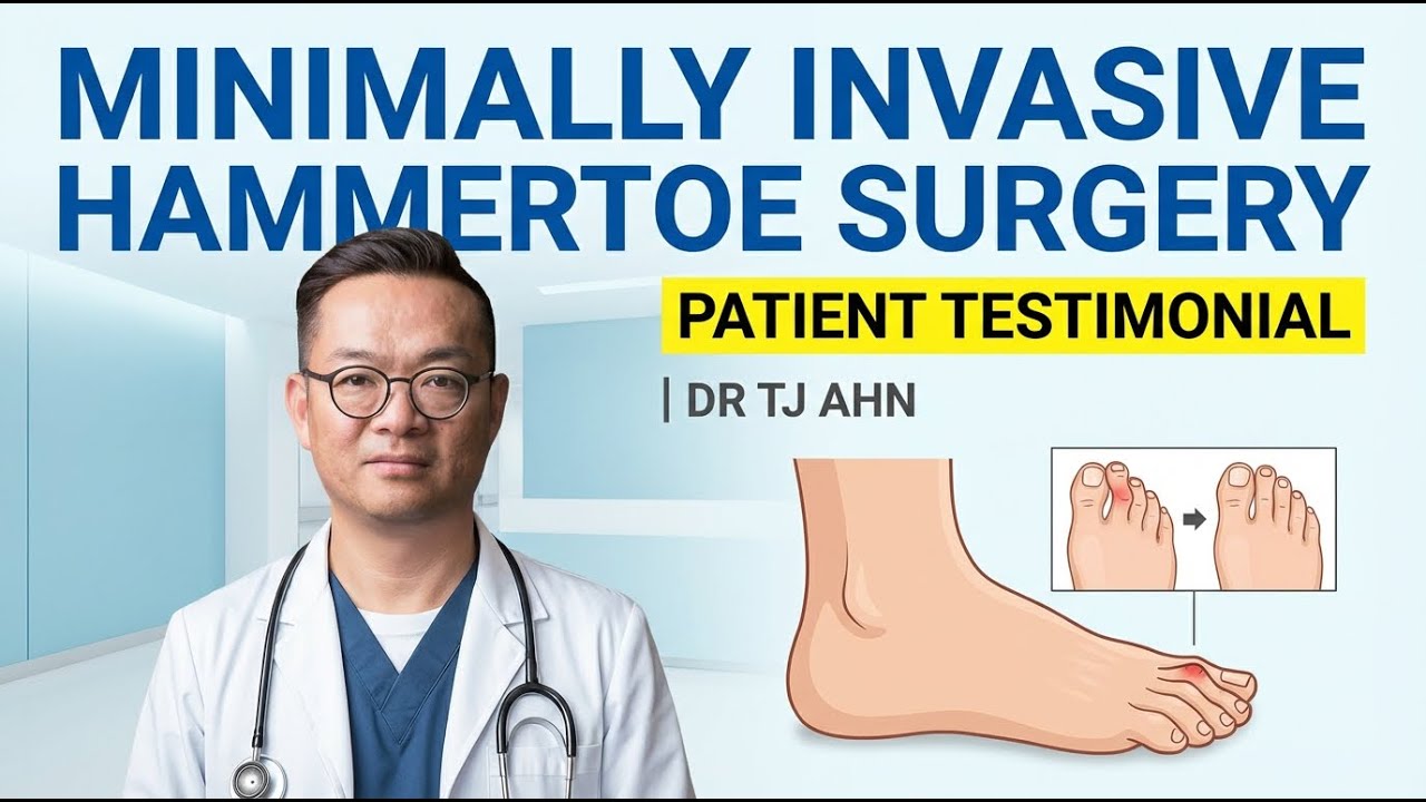 Minimally Invasive Hammertoe Surgery Patient Testimonial │ Dr TJ Ahn ...