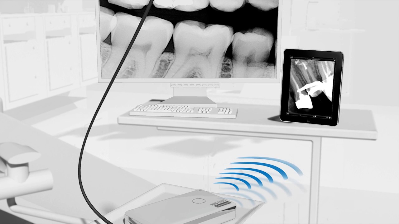 RVG Direct Digital Radiography (DDR) - YouTube