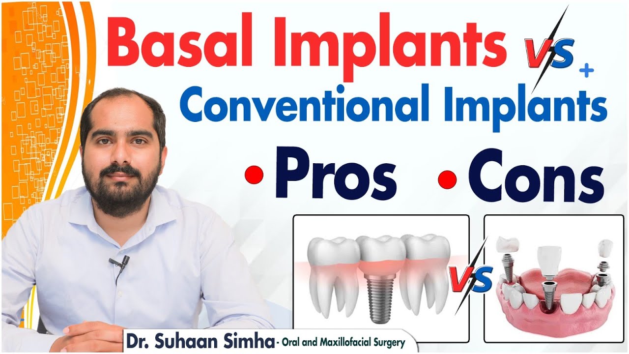 Advantages of Basal Implants Over Conventional Options || Dental ...