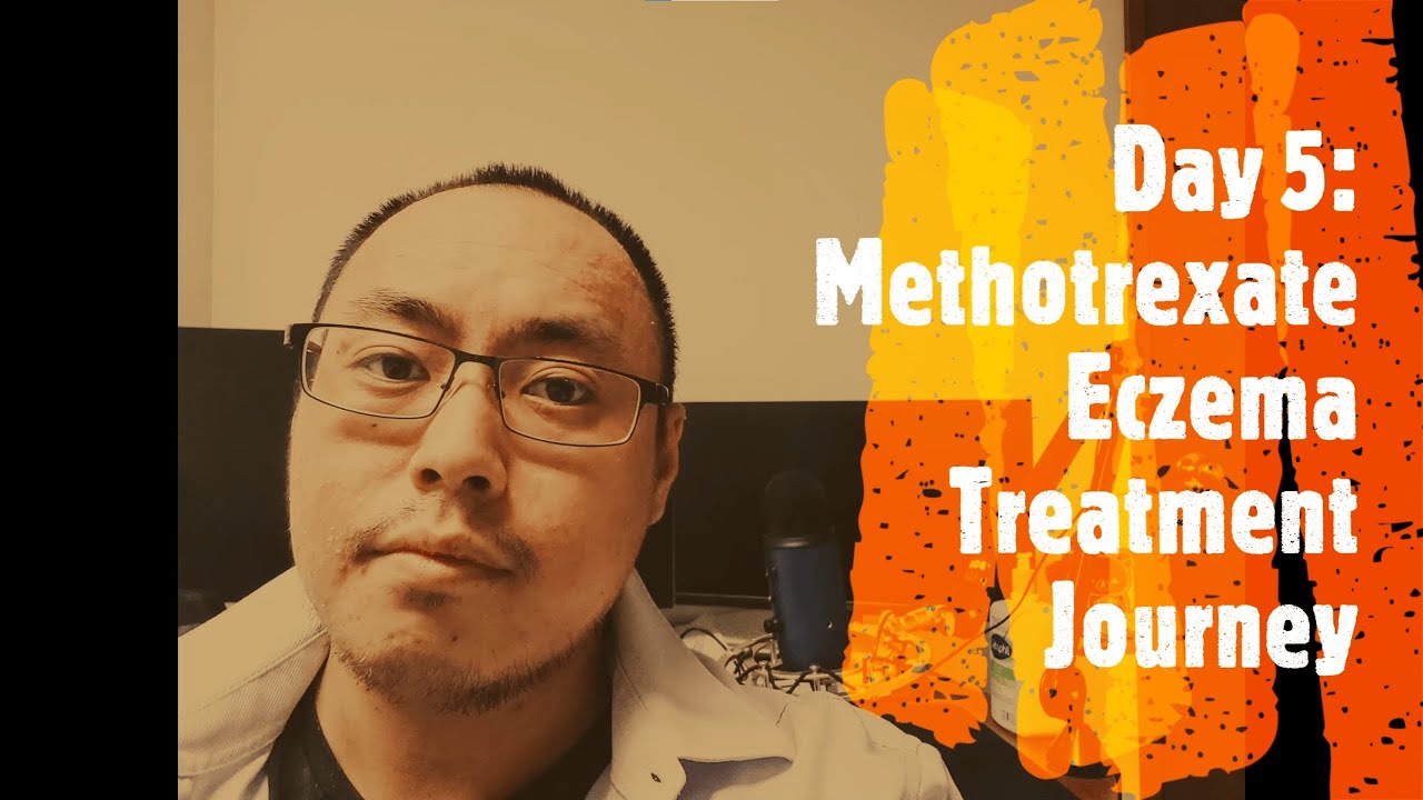 Day 5 - Eczema Journey and First day of Methotrexate - YouTube