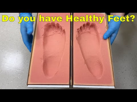 How to take foam impression for flat feet | flat foot orthotics | foot inserts|