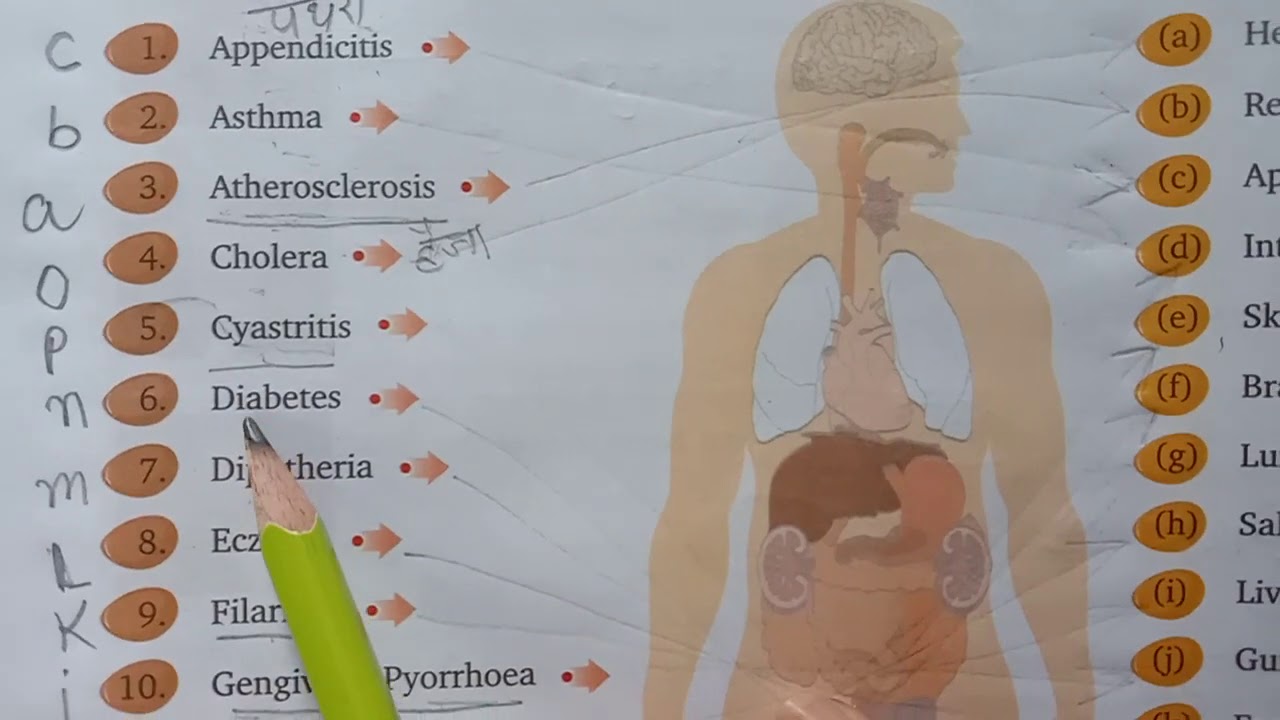 GK Chapter Human Diseases and Affected Organs - YouTube
