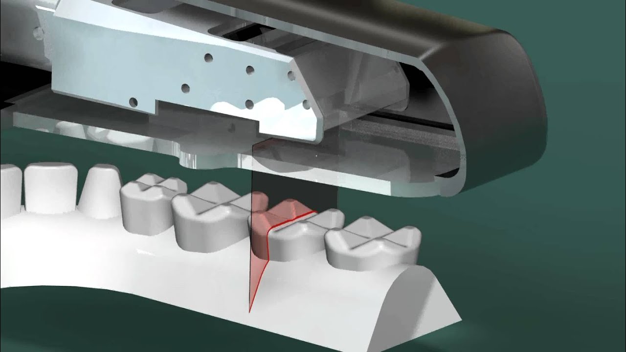 IOS FastScan Laser Sweep Animation - YouTube