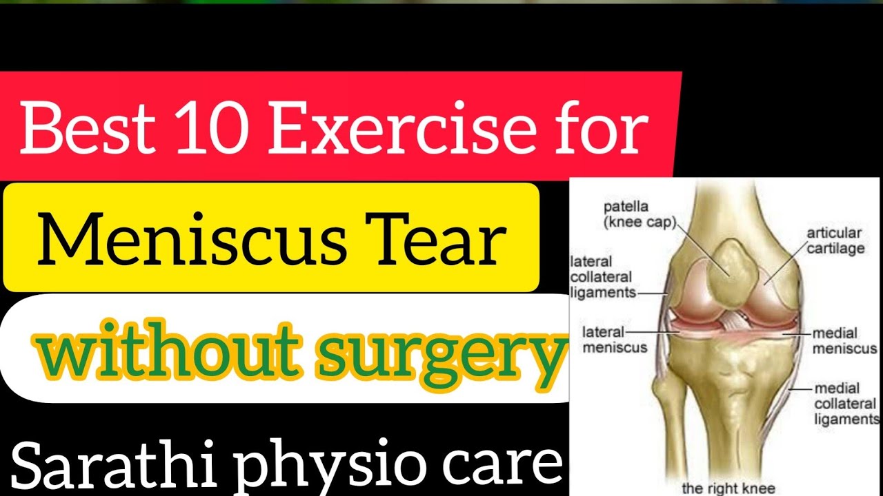 Top 10 Exercises for Meniscus Tear in knee | Exercises to Get rid of ...