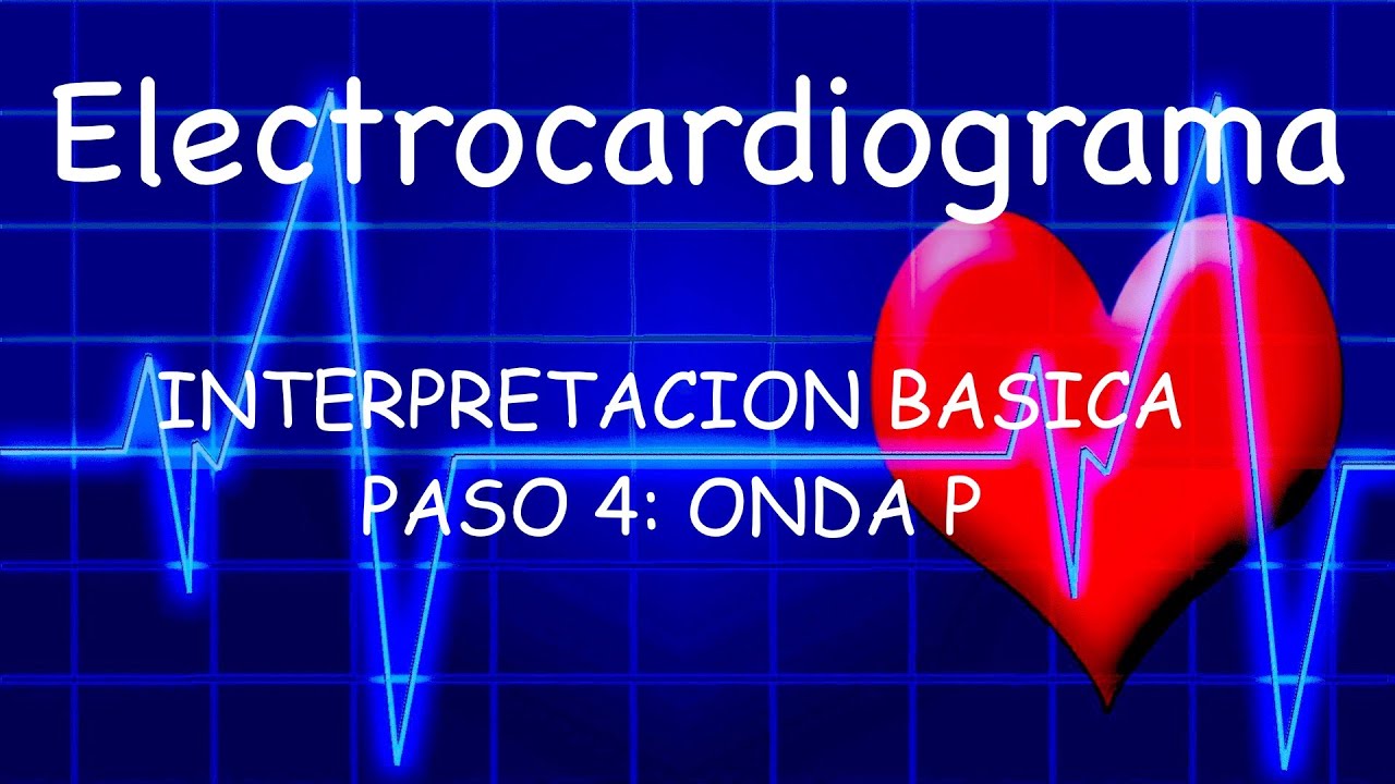 Electrocardiograma Básico: Onda P - YouTube