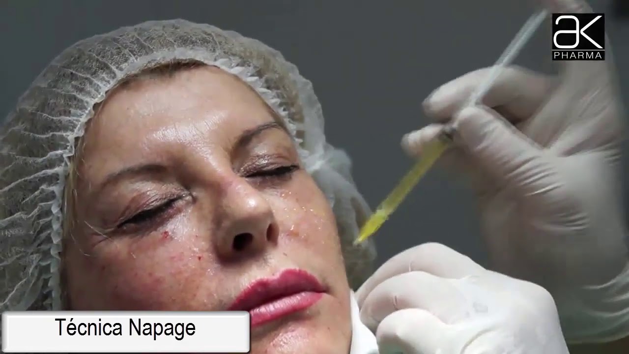 Técnica de Nappage - YouTube